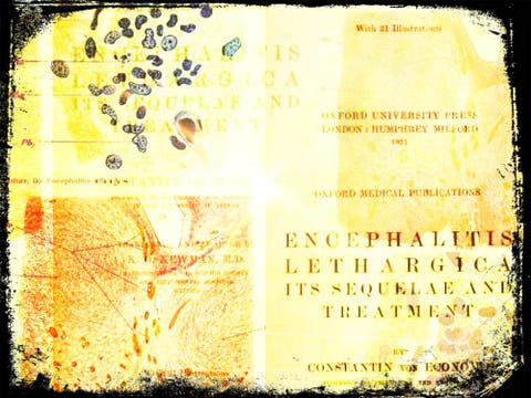 La extraña epidemia de Encefalitis Letárgica - Revista de Historia